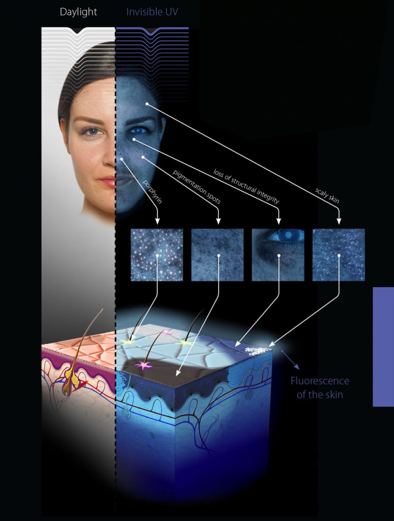 Professional Skin Analysis with Observ | Beauty Within